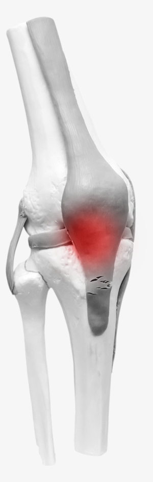 Bone Joint - Free Transparent PNG Download - PNGkey