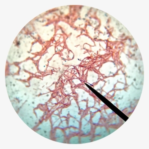 Bacillus Subtilis Endospore Stain - Endospore Stain Under Microscope ...