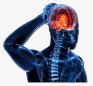 Head Injury - Brain Concussion Png - Free Transparent PNG Download - PNGkey