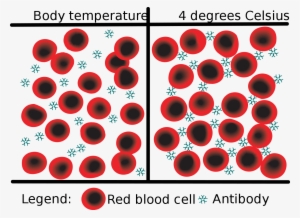 Heterophile Test - Free Transparent PNG Download - PNGkey