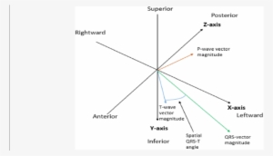 Example Of Determining The P Wave Vector Magnitude - Diagram - Free ...