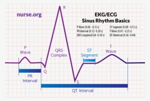 Knowing The Normal Amplitude, Deflection, And Duration - Ecg Reading ...