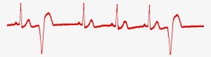 Ekg Line Png Dr - Ekg Transparent - Free Transparent PNG Download - PNGkey
