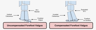 Forefoot Varus And Valgus - Free Transparent PNG Download - PNGkey