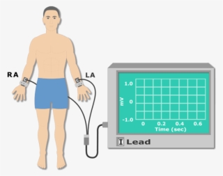 Left Arm Electrode Placement Animation Slide - Free Transparent PNG ...