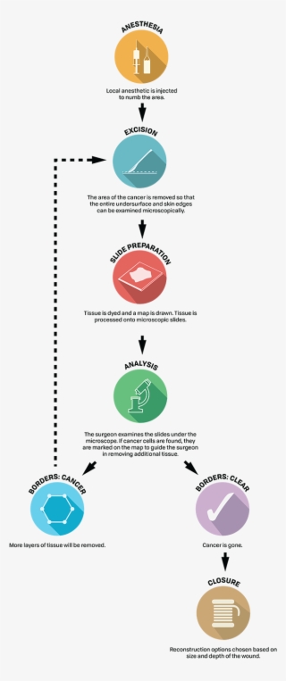 A Look At Mohs Surgery Procedure Steps - Diagram - Free Transparent PNG ...