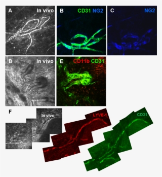 Cornea PNG, Transparent Cornea PNG Image Free Download - PNGkey