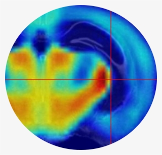 Mouse Brain PNG, Transparent Mouse Brain PNG Image Free Download - PNGkey