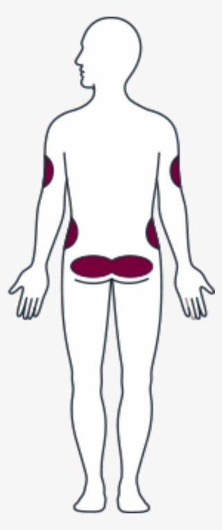 Nurse Cartoon Injection Illustration - Cartoon Injection - Free ...