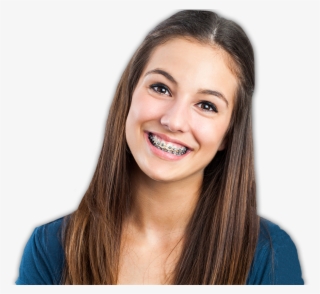 Sonrisa Con Brackets Png - Braces Akridge Orthodontics - Free ...