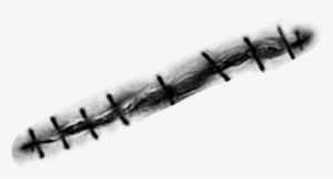 Scar With Stitches Png Picture Free - Stitch Scar Png - Free ...