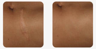 Scars - Wood - Free Transparent PNG Download - PNGkey