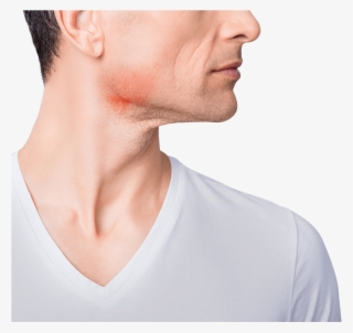 Transparent Skin Causes Transparent Background - Male - Free ...