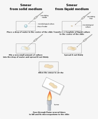 File - Smear - Svg - Przygotowanie Preparatu Mikroskopowego - Free ...